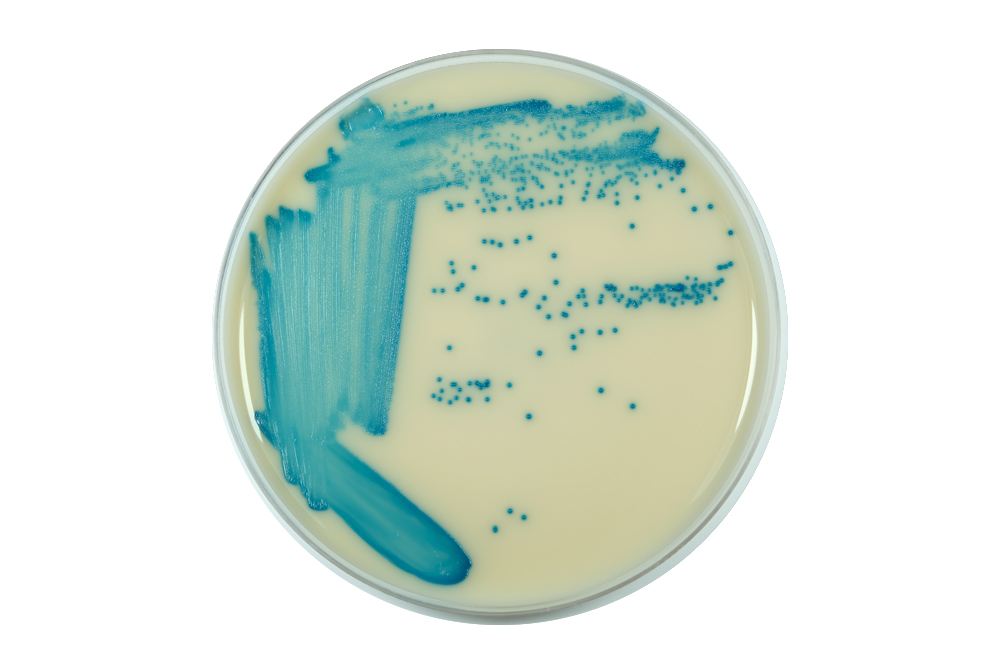 MELAB Chromogenic UTI Agar