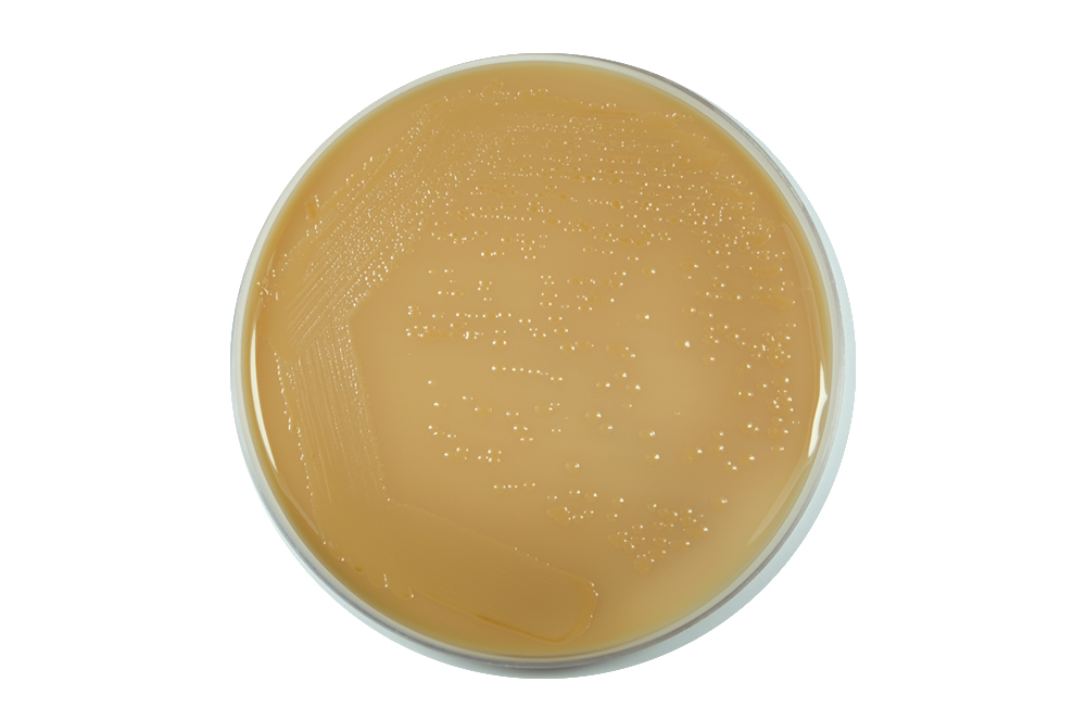 MELAB Chromogenic UTI Agar