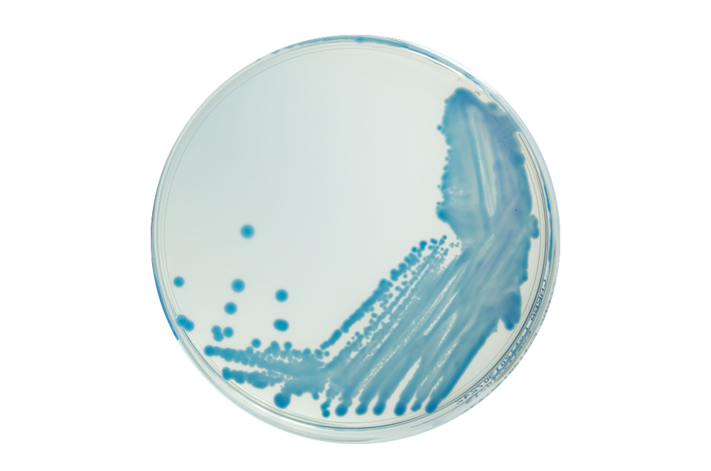 MELAB Chromogenic CARBA Agar