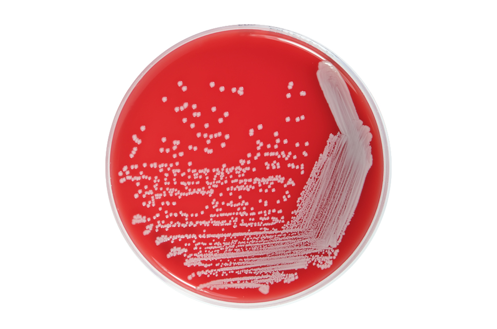 MELAB Columbia Agar + 5% Sheep Blood