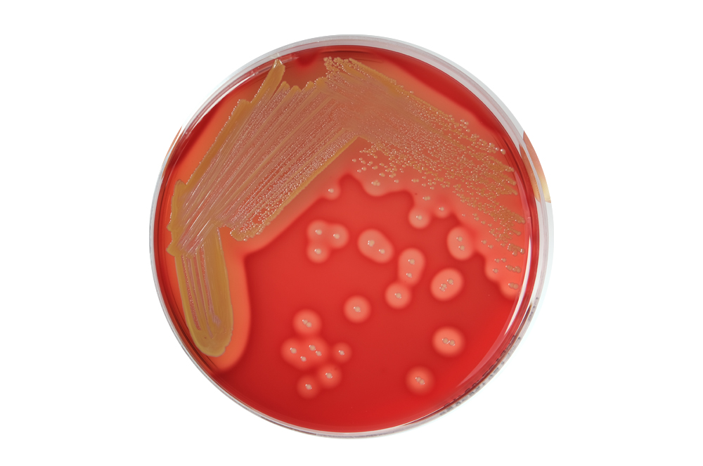 MELAB Columbia Agar + 5% Sheep Blood