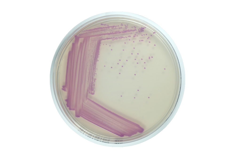 MELAB Chromogenic Strepto B Agar
