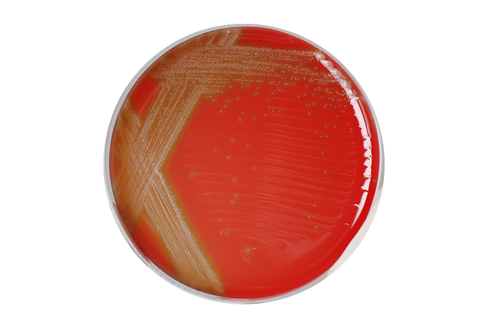 MELAB Columbia Agar + 5% Sheep Blood