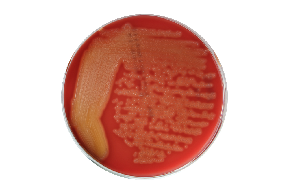 MELAB Columbia Agar + 5% Sheep Blood